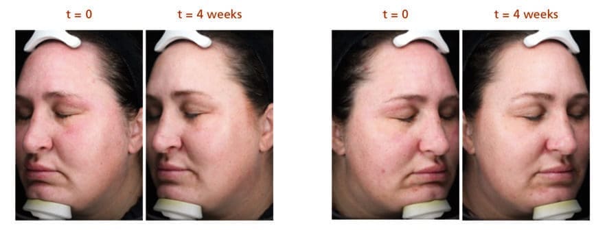 Neurocosmetics: all about acting on the complete skin-brain feedback ...