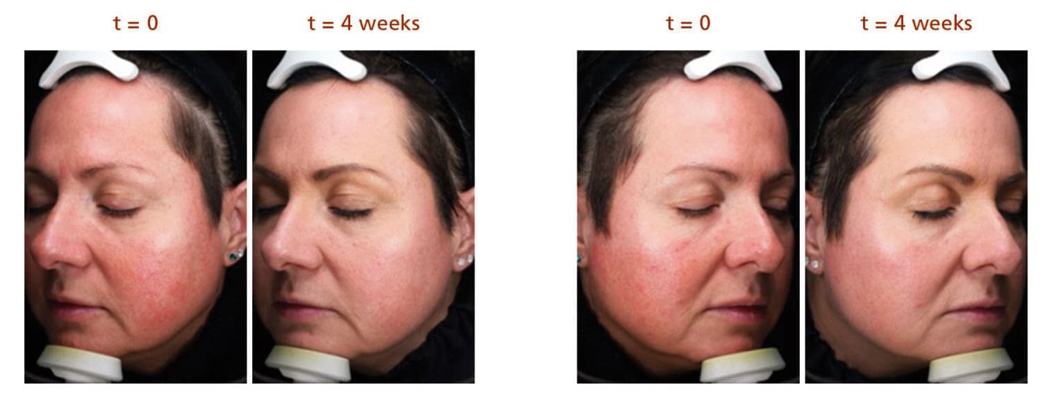 Neurocosmetics: all about acting on the complete skin-brain feedback ...